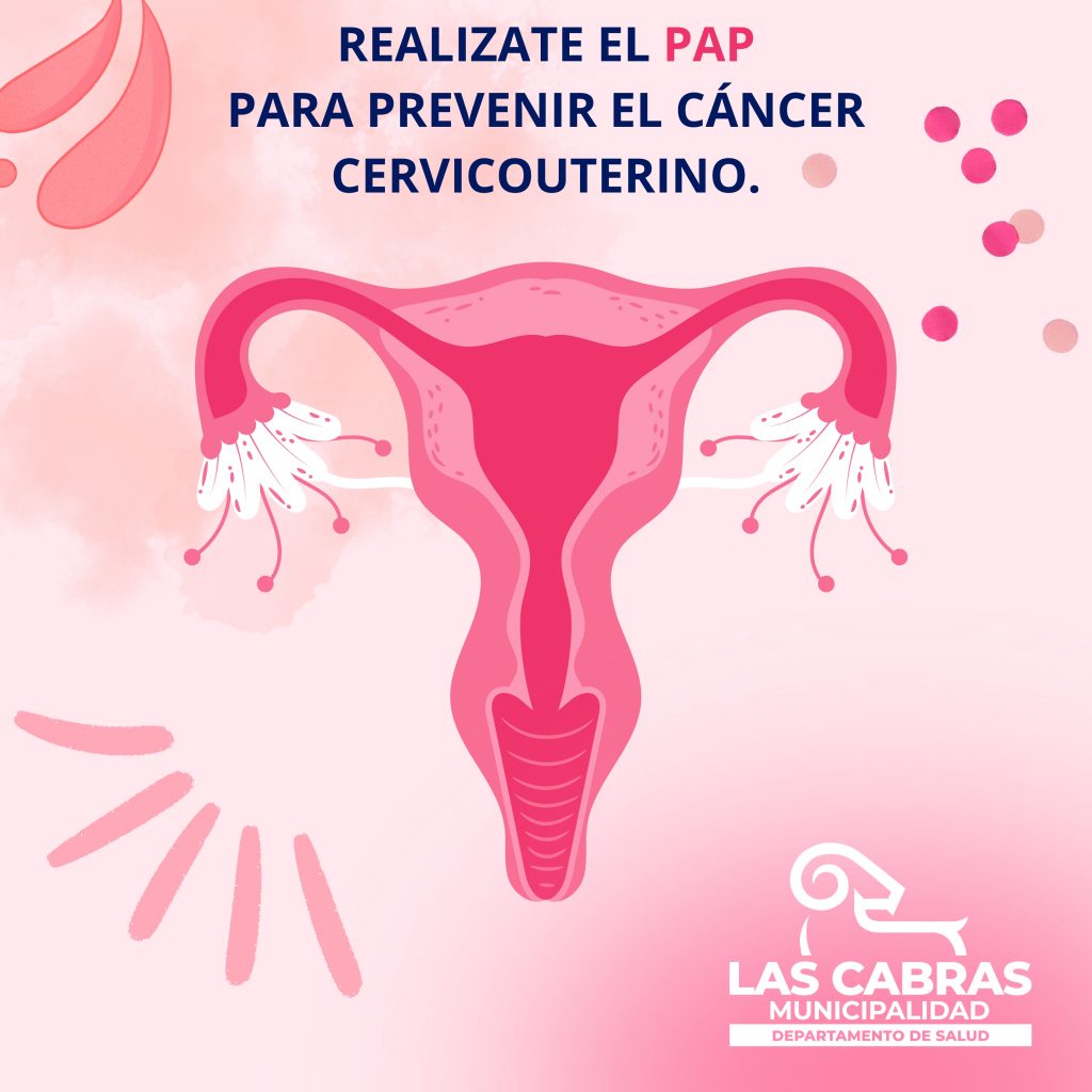 EXAMEN PAPANICOLAU «PAP» | SALUD LAS CABRAS